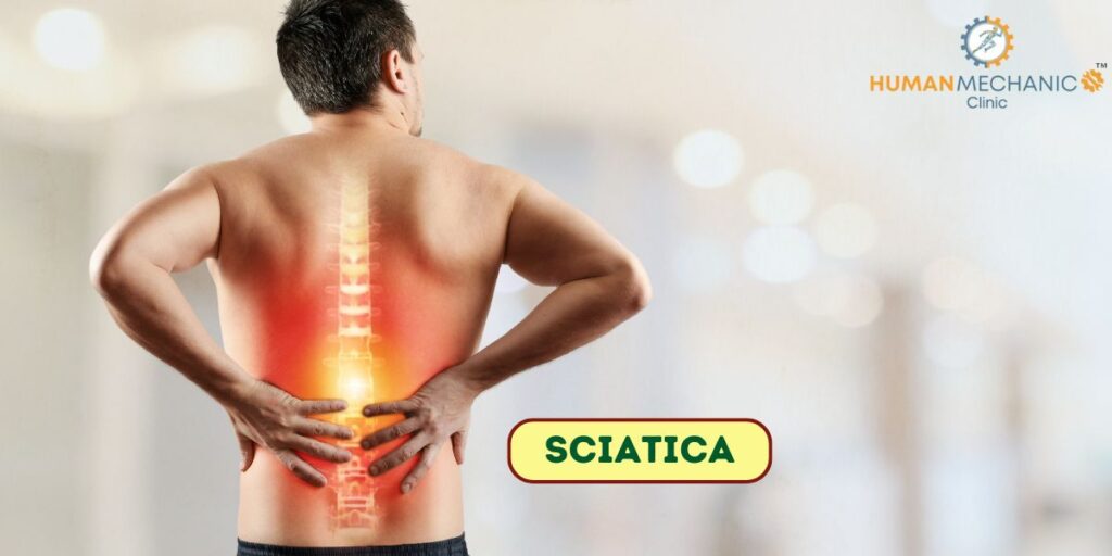 How To Manage Sciatica Pain with Physiotherapy - Human Mechanic Clinic