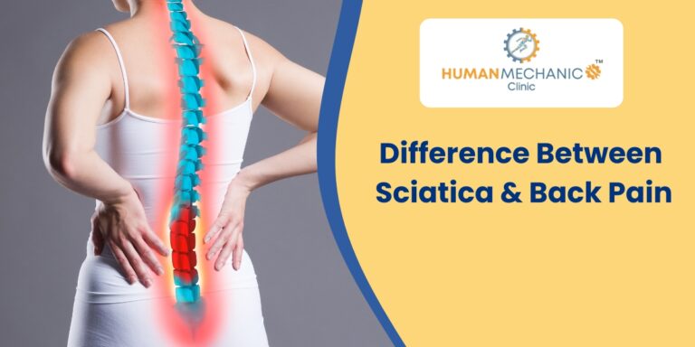 Sciatica vs. General Back Pain: How to Tell the Difference - Human Mechanic Clinic